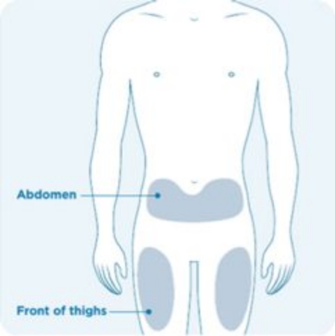 Frequently Asked Questions (FAQs) | Food Allergy | XOLAIR