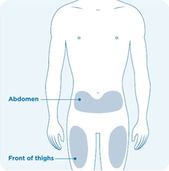 Frequently Asked Questions (FAQs) | Chronic Rhinosinusitis with Nasal ...