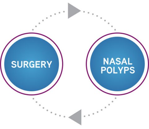 How To Get Rid Of Nose Polyps Naturally At Home Without Surgery How To